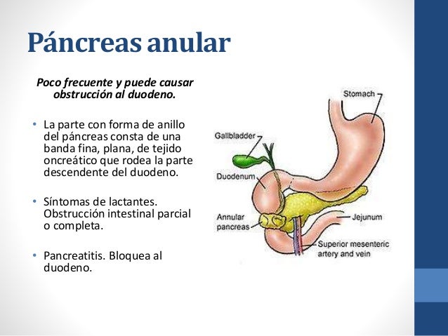 Anomalías del Aparato Digestivo - Embriología