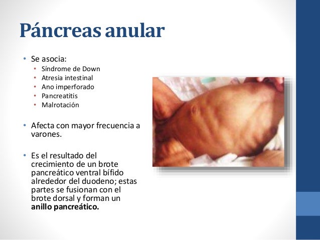 Anomalías del Aparato Digestivo - Embriología