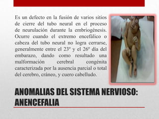 Anomalias congenitas | PPTX
