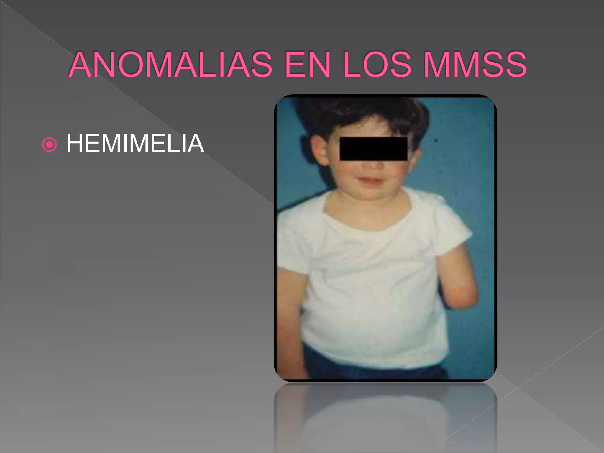 Anomalias congenitas del desarrollo | PPTX