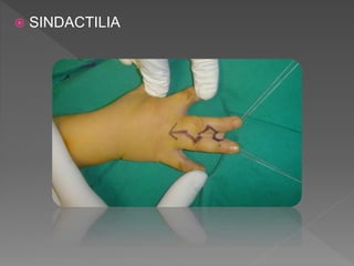 Anomalias congenitas del desarrollo | PPTX | Blood Disorders | Diseases ...