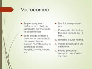 Anomalias congenitas oftalmo | PPTX
