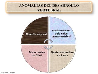 Anomalias del desarrollo vertebral - Neurocirugía | PPTX