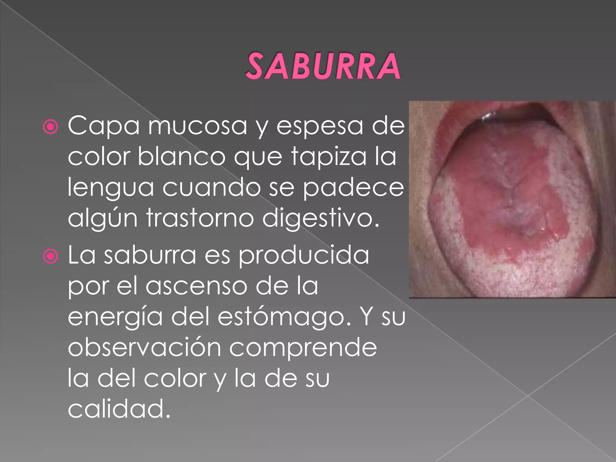 Anomalias del sentido del gusto | PPTX