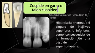ANOMALIAS DENTARIAS PDF.pdfdiagnosticoxi | PDF