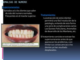 Anomalias de numero | PPTX