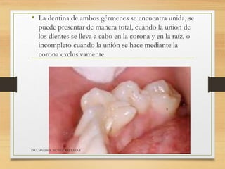 Anomalias en los dientes | PPTX