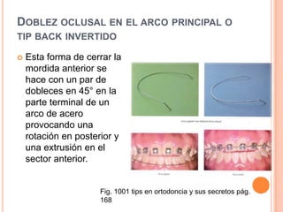 Anomalias verticales ortodoncia diagnostico y tratamiento | PPTX