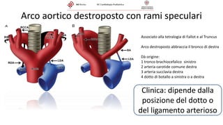 Anomalie dell'arco aortico 2016 | PPTX