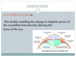 Anomalies of accomodation ‫‬ | PPTX