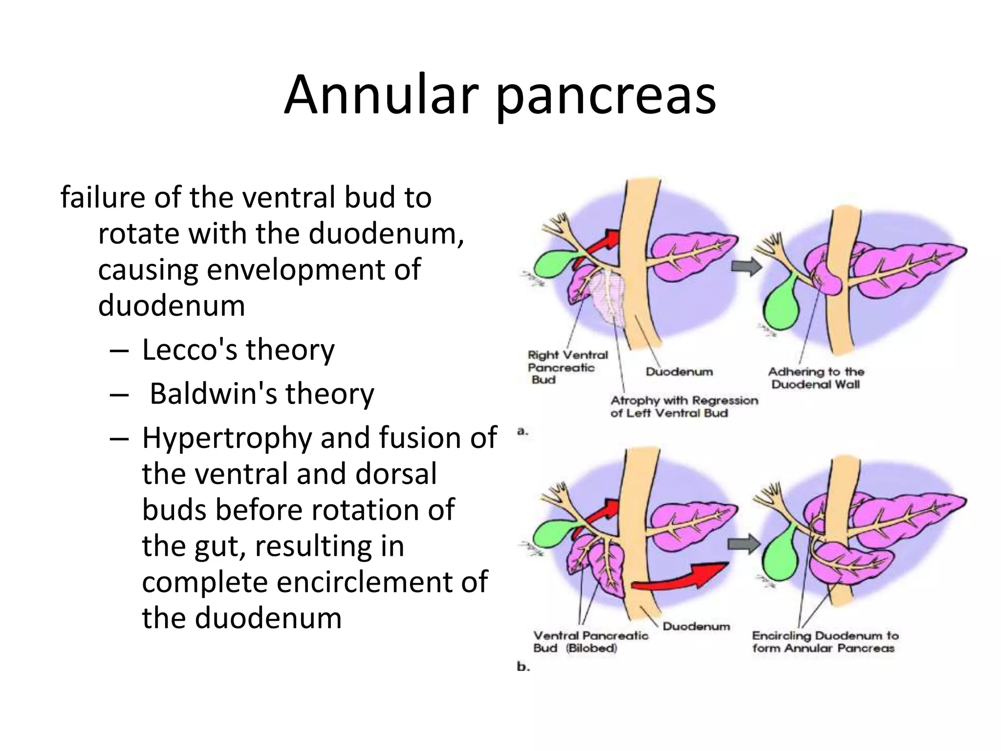 Anomalies of biliary tree | PPTX