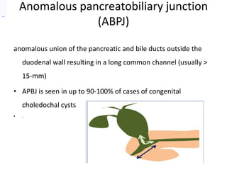 Anomalies of biliary tree | PPTX