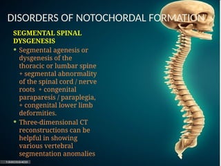 anomalies of caudal cell mass:anomalies of human spine.pptx