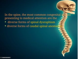 anomalies of caudal cell mass:anomalies of human spine.pptx