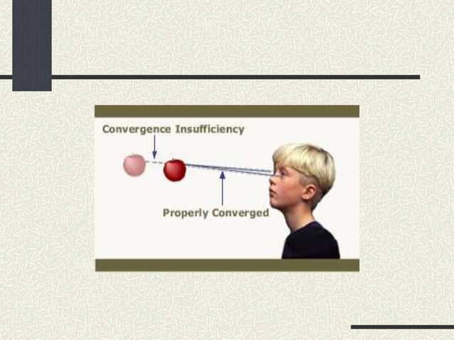 Anomalies Of Convergence | PPT