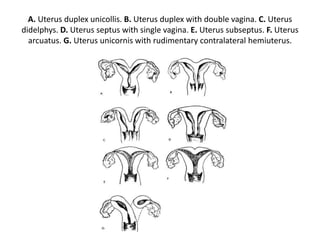 Anomalies of Female Reproductive System (Embryology-uterus, uterine ...