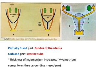 Anomalies of Female Reproductive System (Embryology-uterus, uterine ...
