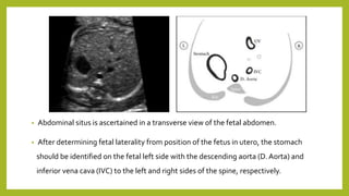 Anomalies of fetal cardiac system | PPTX