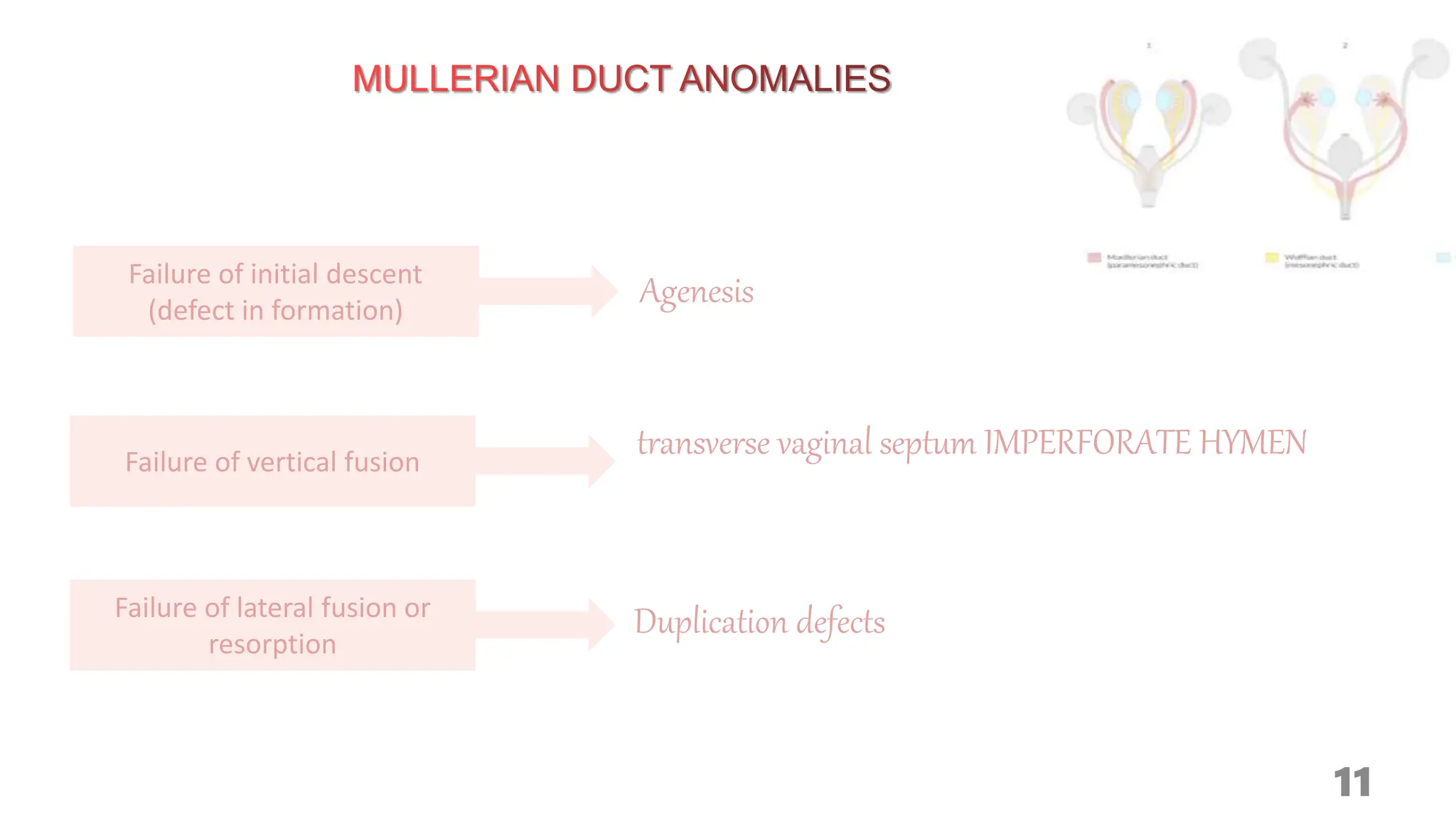 Congenital anomalies of female genital tract.pptx