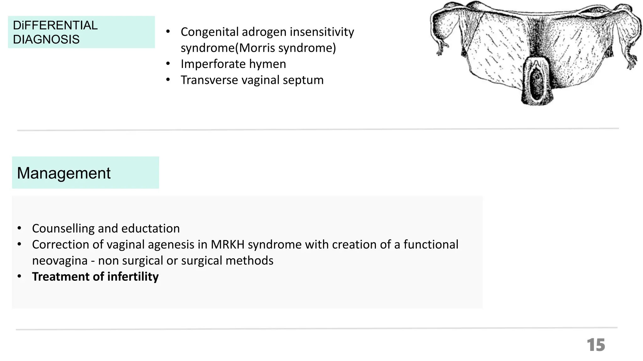 Congenital anomalies of female genital tract.pptx