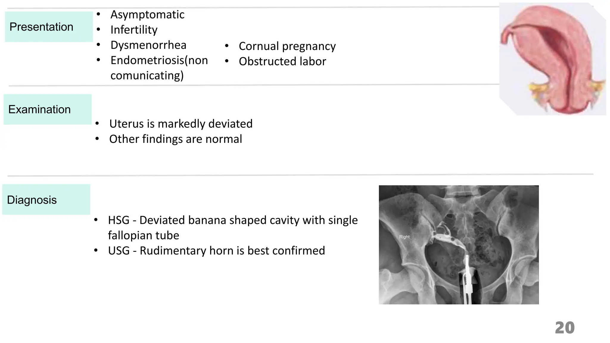 Congenital anomalies of female genital tract.pptx