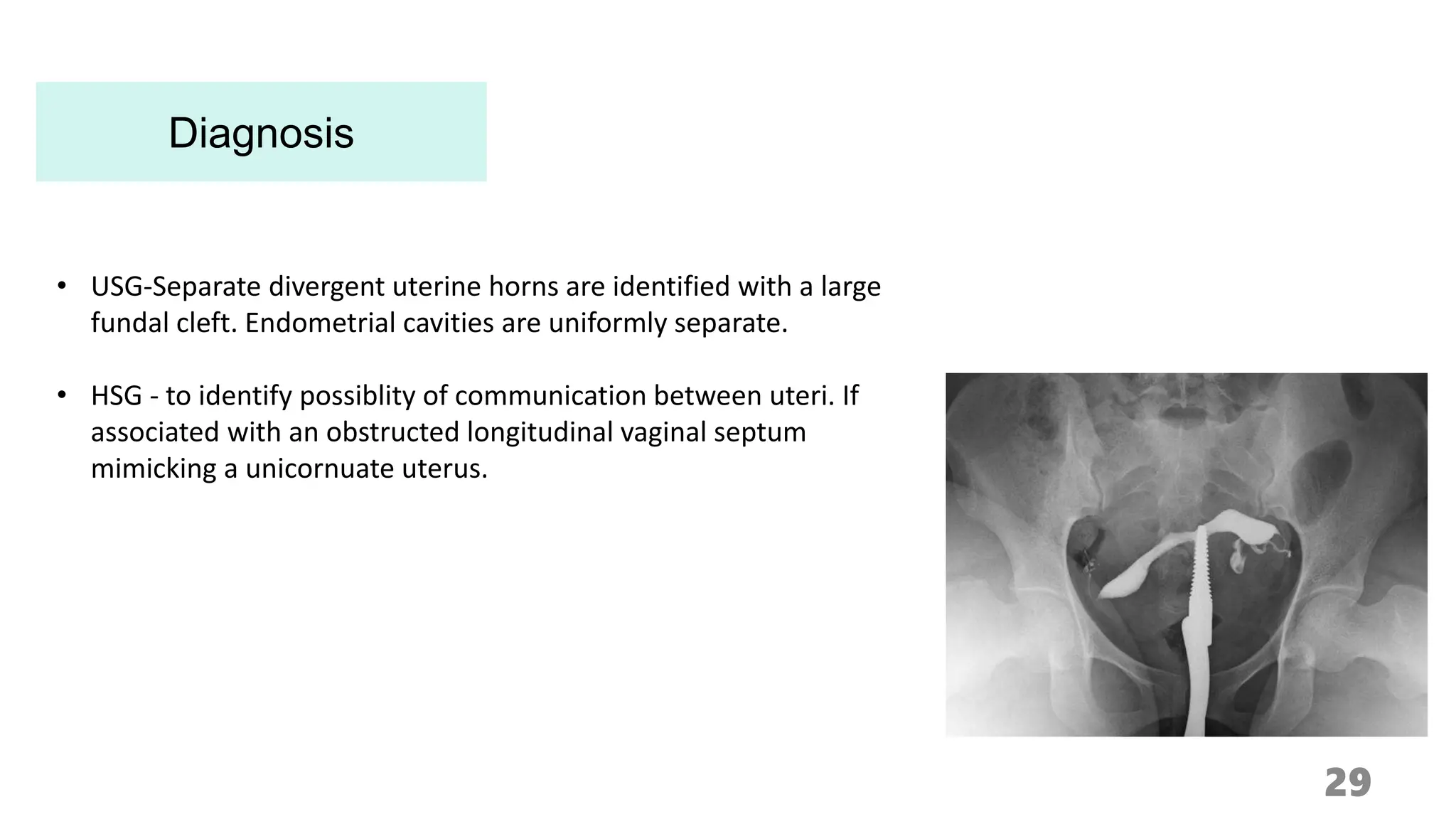 Congenital anomalies of female genital tract.pptx