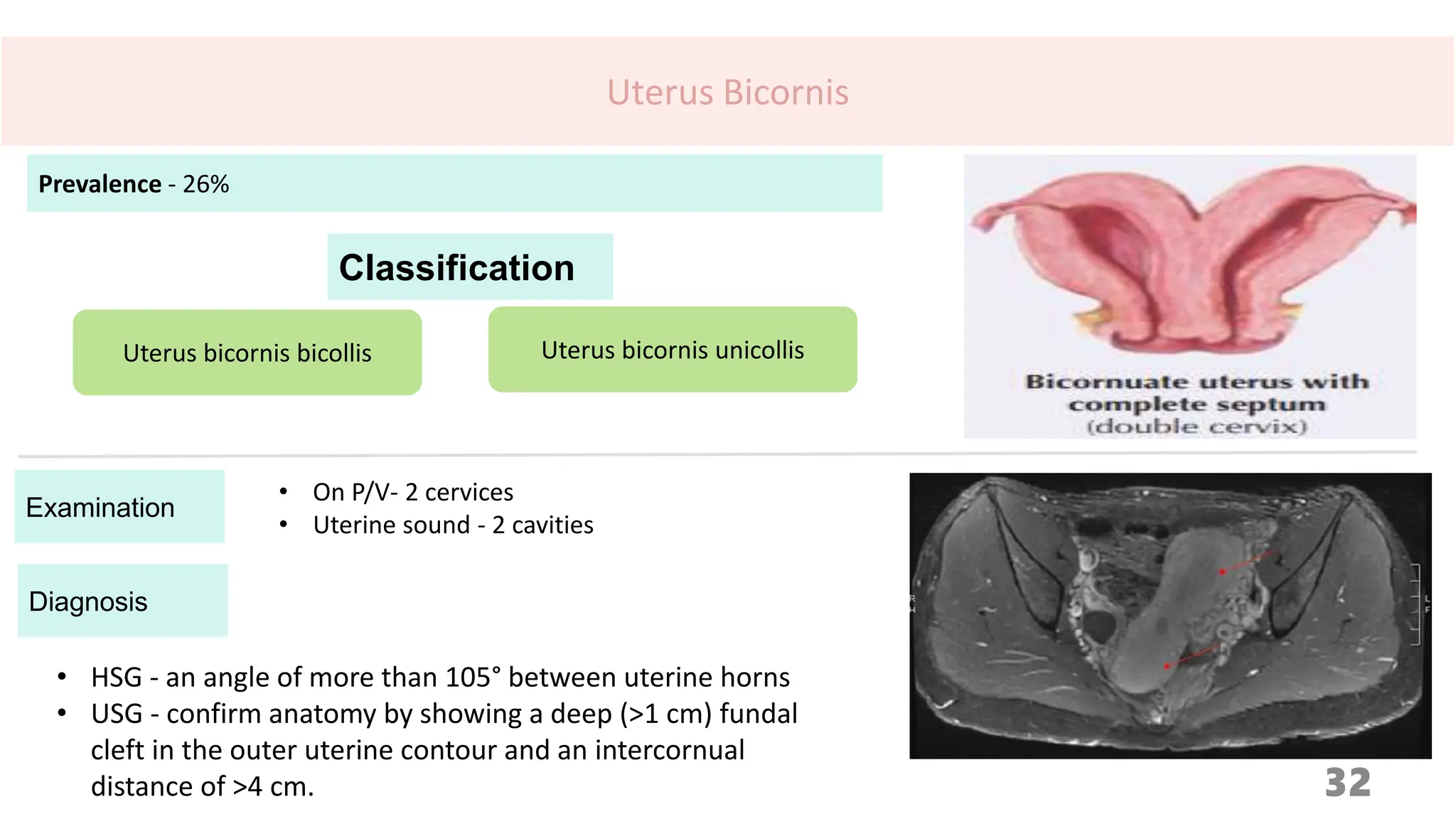 Congenital anomalies of female genital tract.pptx