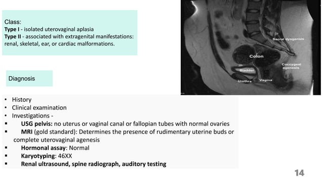Congenital anomalies of female genital tract.pptx | Pregnancy ...