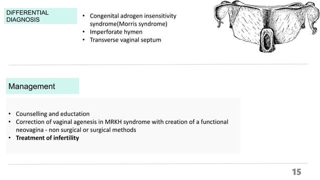 Congenital anomalies of female genital tract.pptx | Pregnancy ...