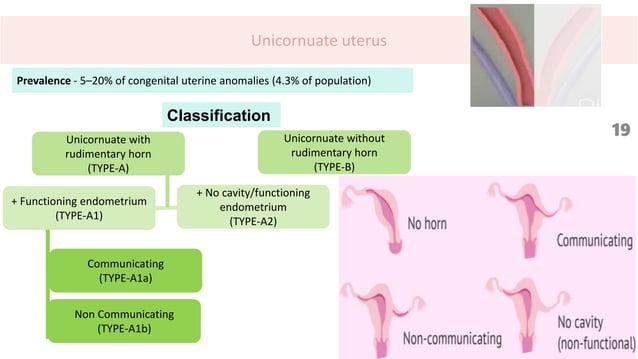 Congenital anomalies of female genital tract.pptx | Pregnancy ...