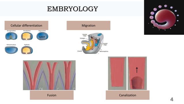Congenital anomalies of female genital tract.pptx | Pregnancy ...