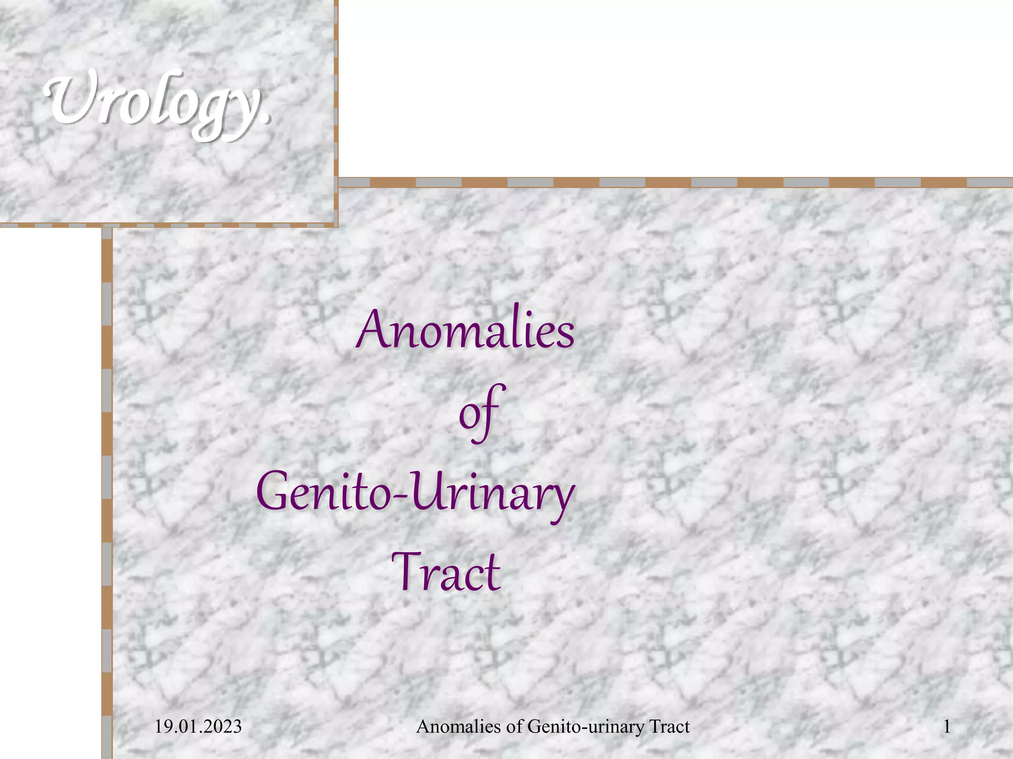 Anomalies of Genito-Urinary Tract.ppt