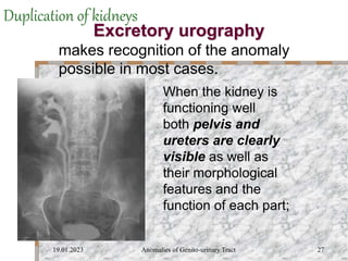 Anomalies of Genito-Urinary Tract.ppt