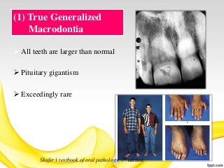 Developmental Anomalies Of Teeth | PPTX
