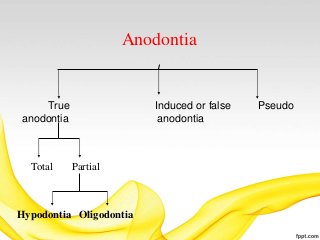Developmental Anomalies Of Teeth | PPTX