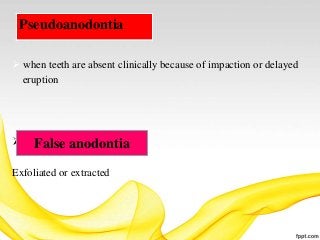 Developmental Anomalies Of Teeth | PPTX
