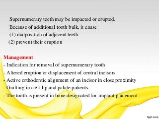 Developmental Anomalies Of Teeth | PPTX