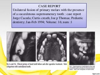Developmental Anomalies Of Teeth | PPTX