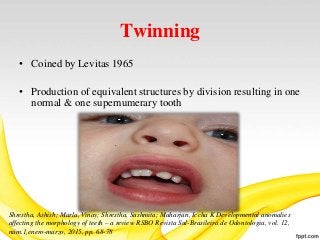 Developmental Anomalies Of Teeth | PPTX