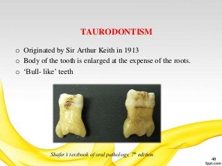 Developmental Anomalies Of Teeth | PPTX