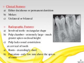 Developmental Anomalies Of Teeth | PPTX