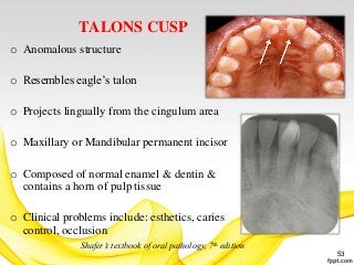 Developmental Anomalies Of Teeth | PPTX