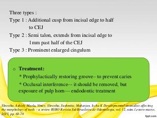Developmental Anomalies Of Teeth | PPTX