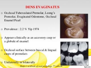 Developmental Anomalies Of Teeth | PPTX