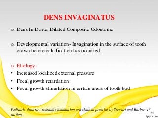 Developmental Anomalies Of Teeth | PPTX
