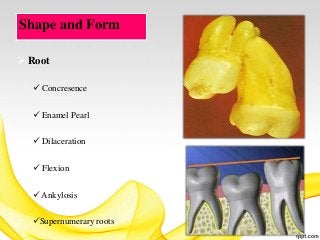 Developmental Anomalies Of Teeth | PPTX