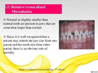 Developmental Anomalies Of Teeth | PPTX