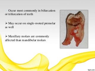 Developmental Anomalies Of Teeth | PPTX
