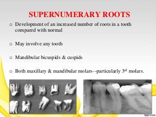 Developmental Anomalies Of Teeth | PPTX