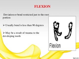 Developmental Anomalies Of Teeth | PPTX